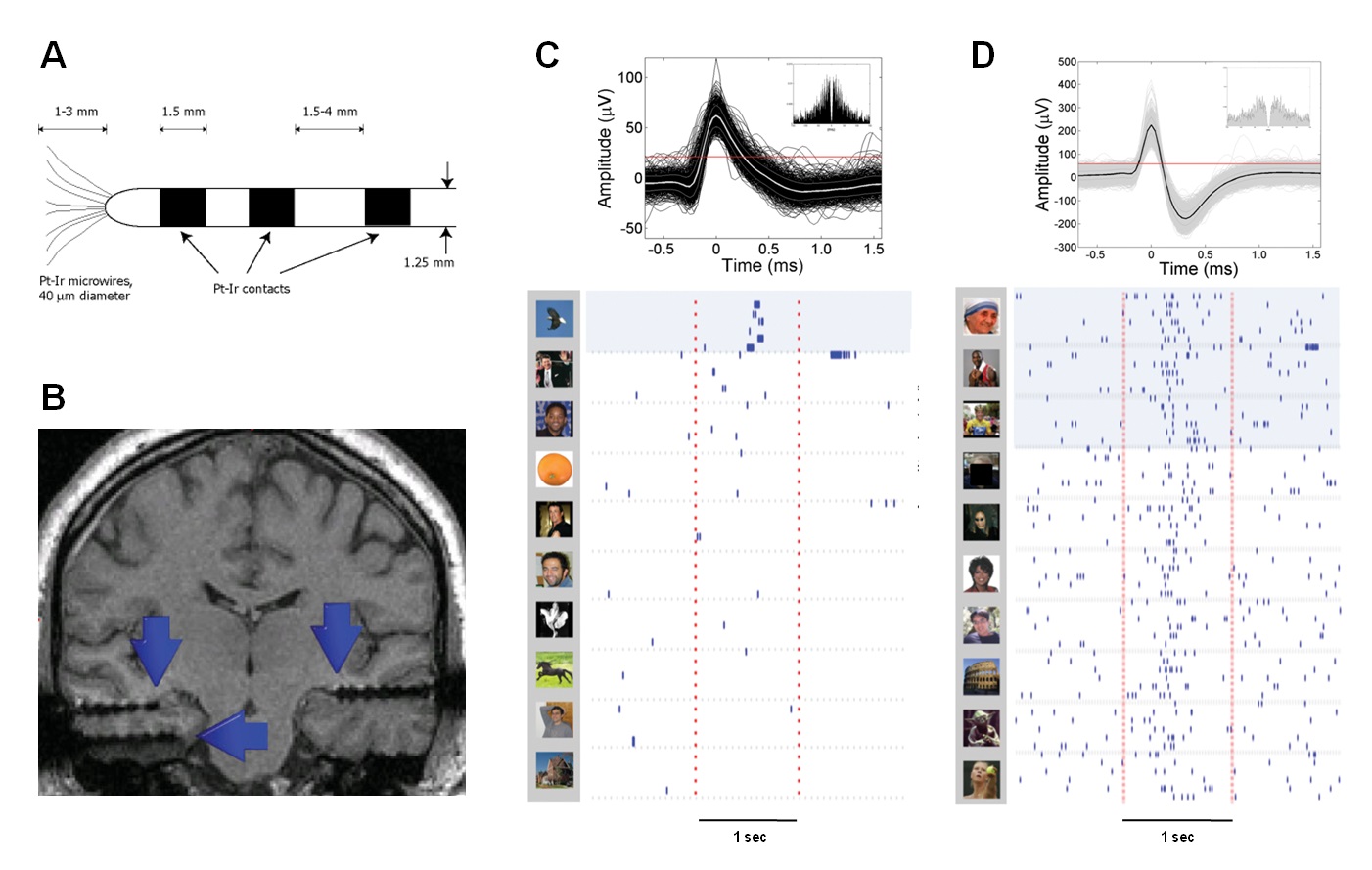 D03 Dissociating neuronal representations of contents and texture along ...